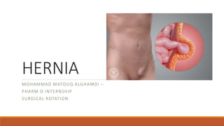 Hernia | Case Study | PPTX