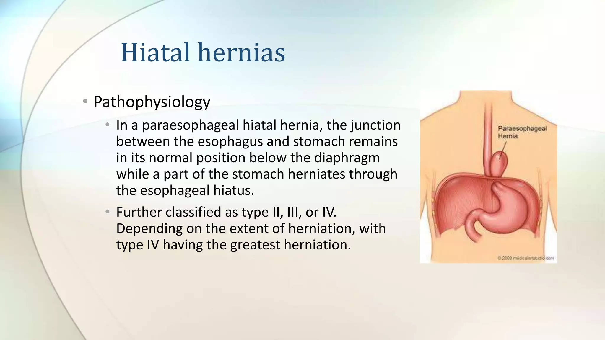 Nursing care of patients with Hernia | PPTX