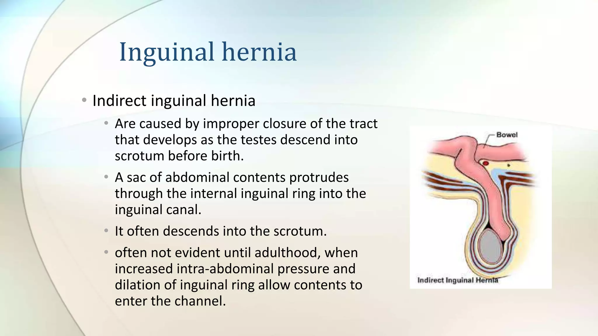 Nursing care of patients with Hernia | PPTX
