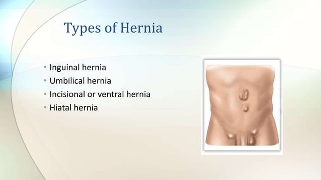 Nursing care of patients with Hernia | PPTX | Digestive Disorders | Diseases and Conditions