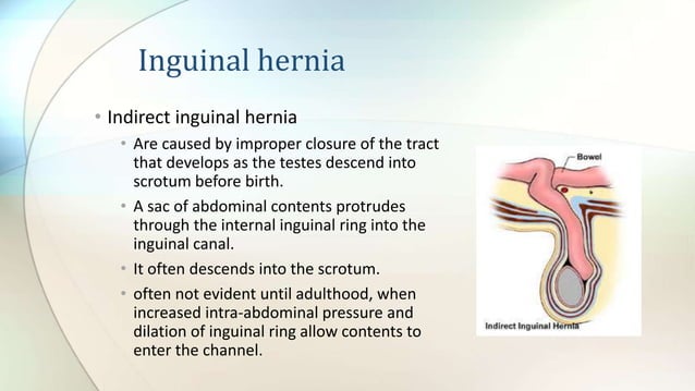 Nursing care of patients with Hernia | PPTX | Digestive Disorders | Diseases and Conditions