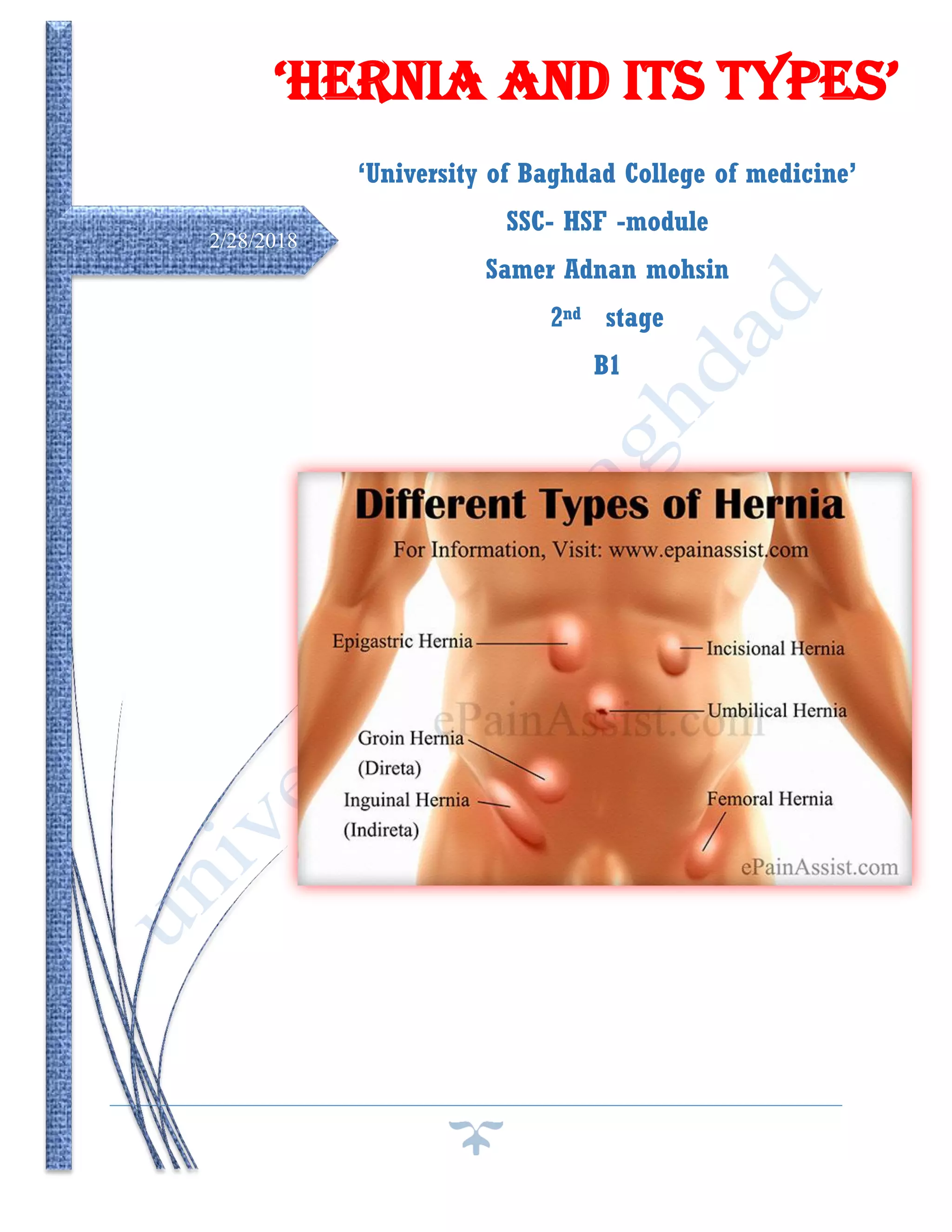 Hernia 2018 | PDF