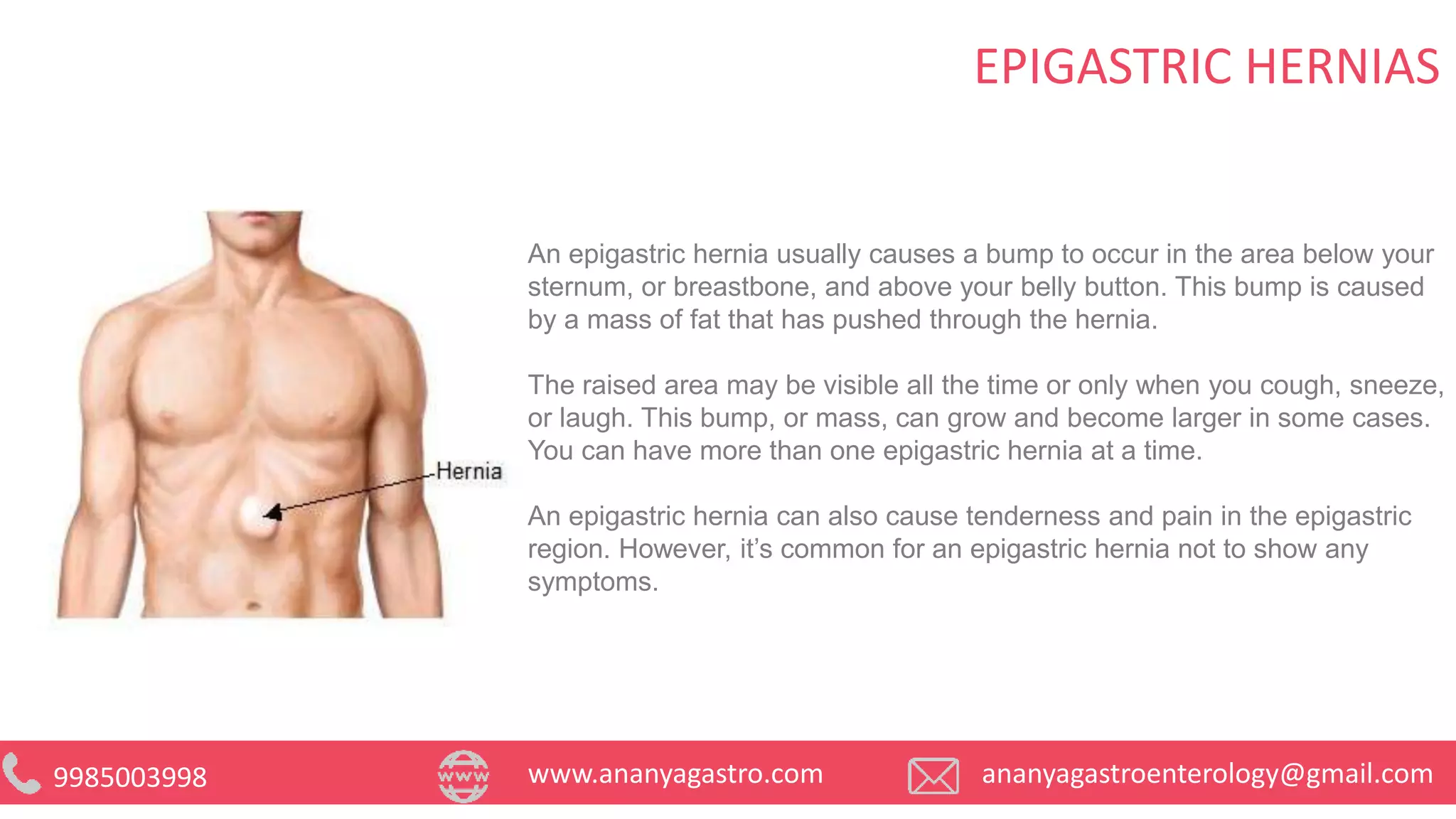 What Is a Hernia? Types of Hernias | PPTX | Pregnancy | Reproductive Health