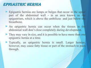 Hernia | PPT