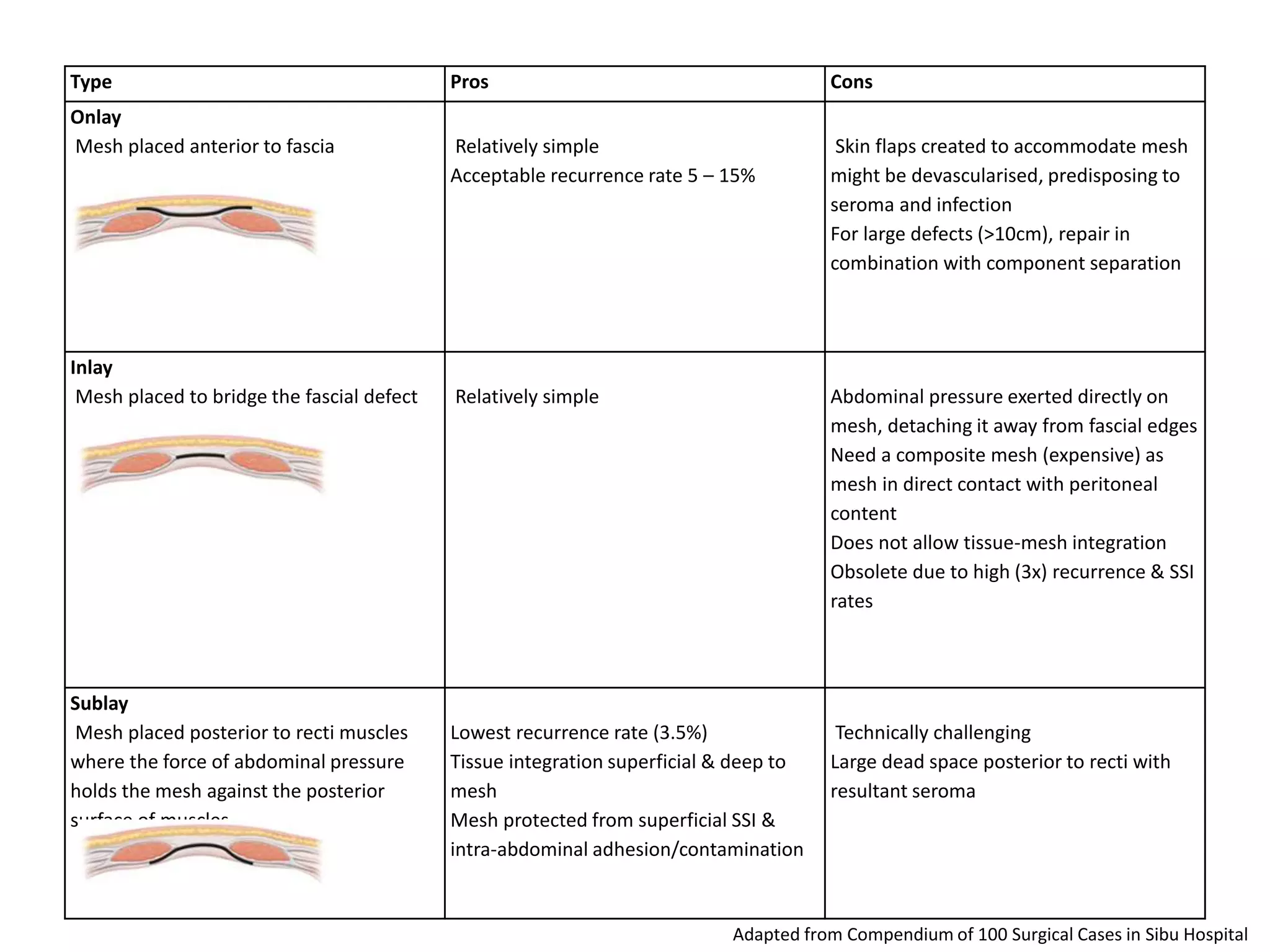 Hernia | PPTX