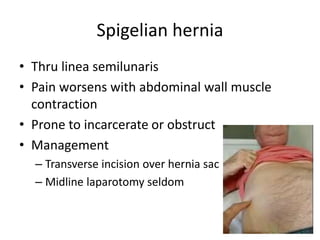 Hernia | PPTX | Pregnancy | Reproductive Health