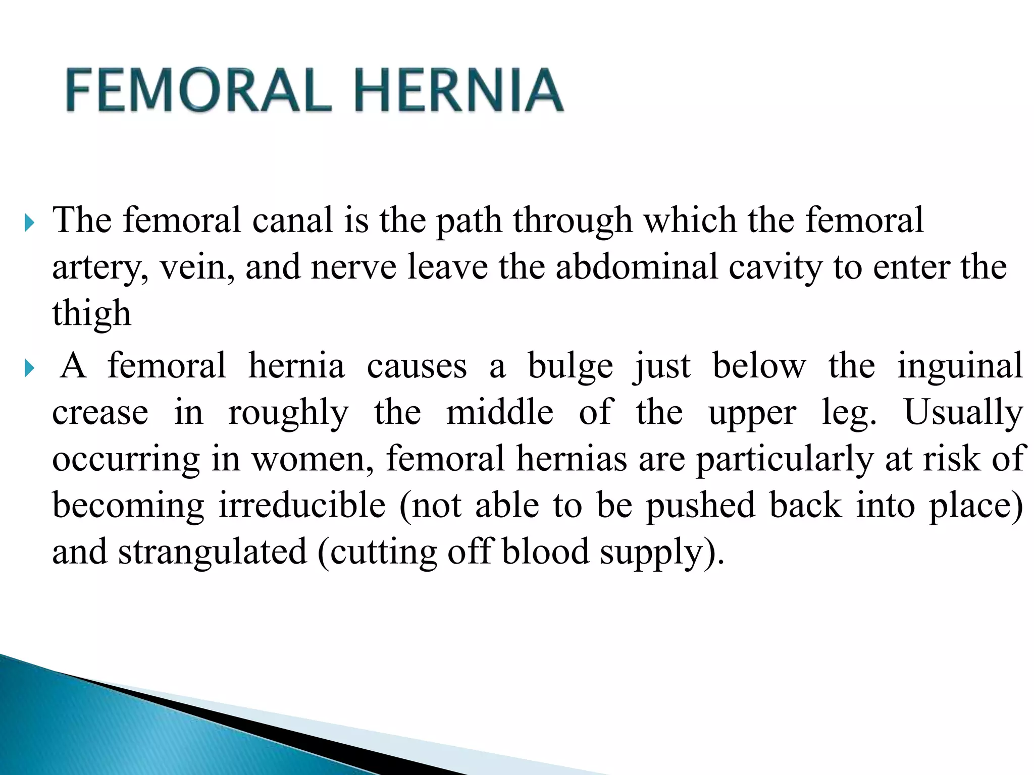 Hernia | PPTX
