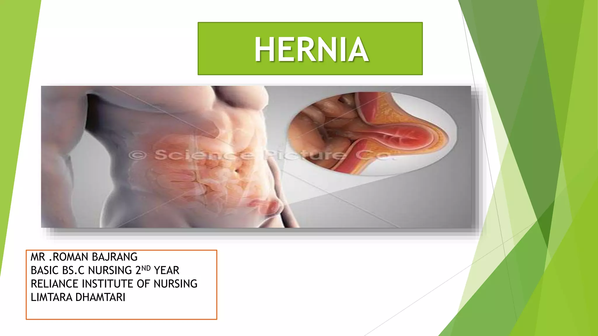HERNIA PATIENT | PPT