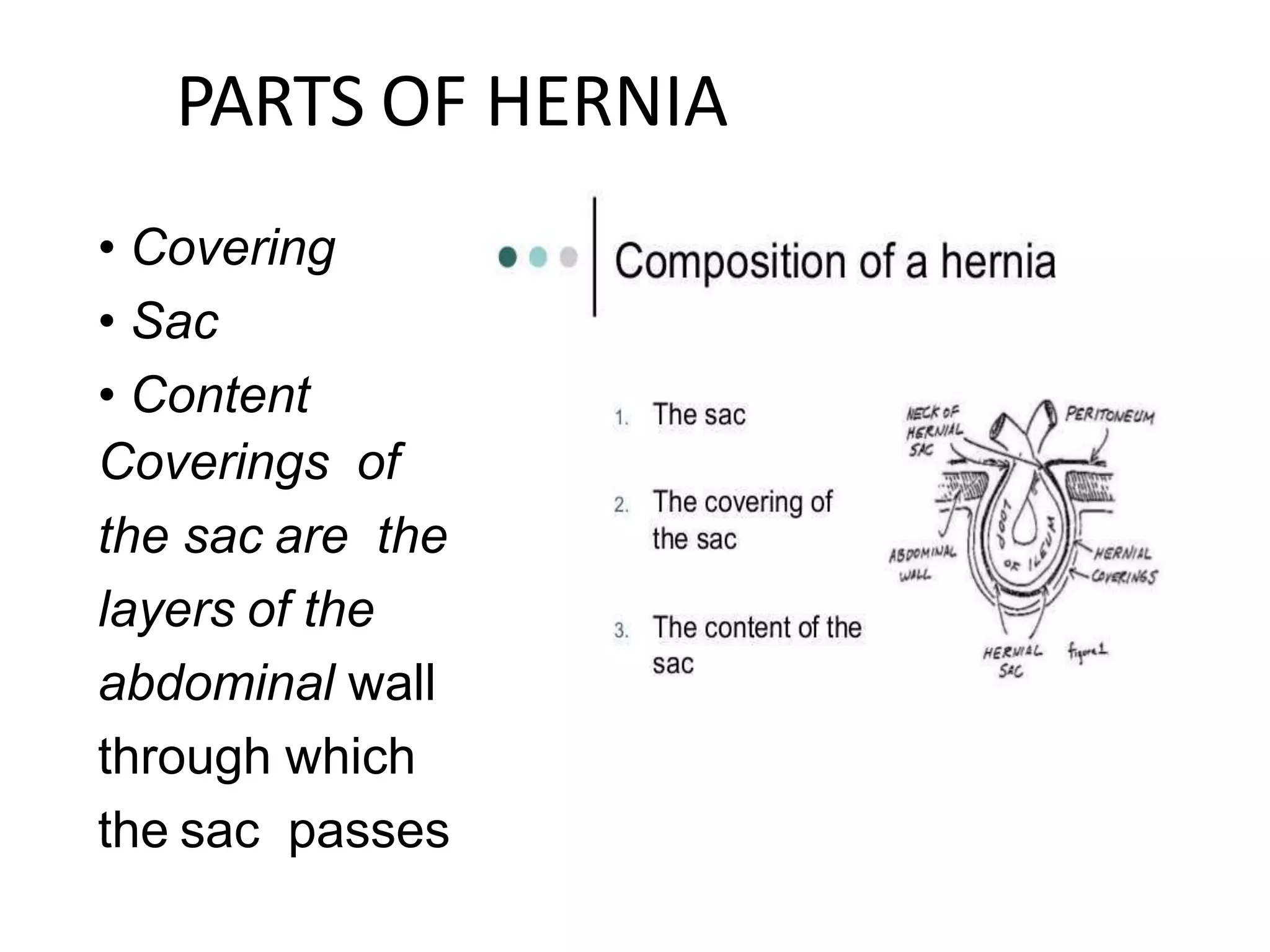 Hernia | PPTX