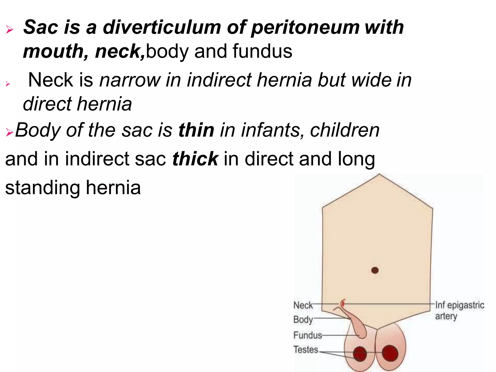 Hernia | PPTX