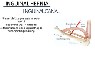 Hernia | PPTX