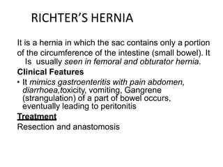 Hernia | PPT