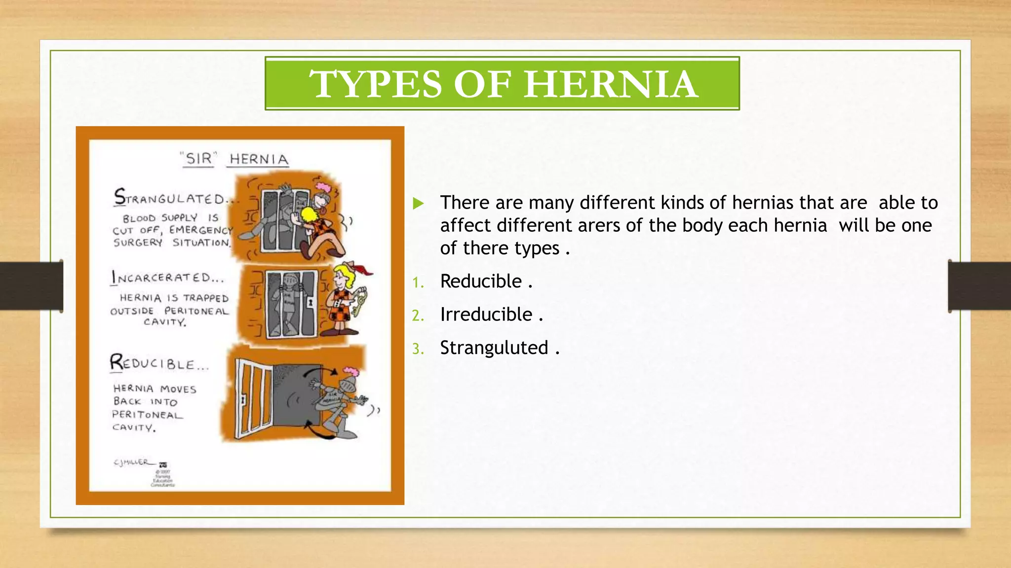 Hernia ppt | PPTX