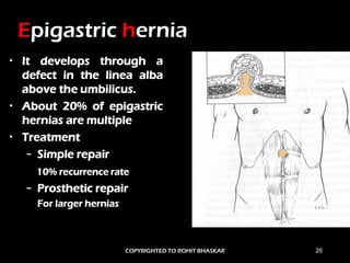 Hernia - Physiotherapy - Dr Rohit Bhaskar | PDF