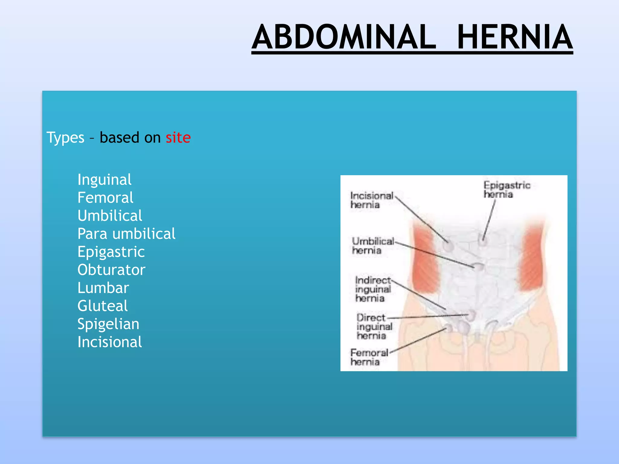 Hernia | PDF