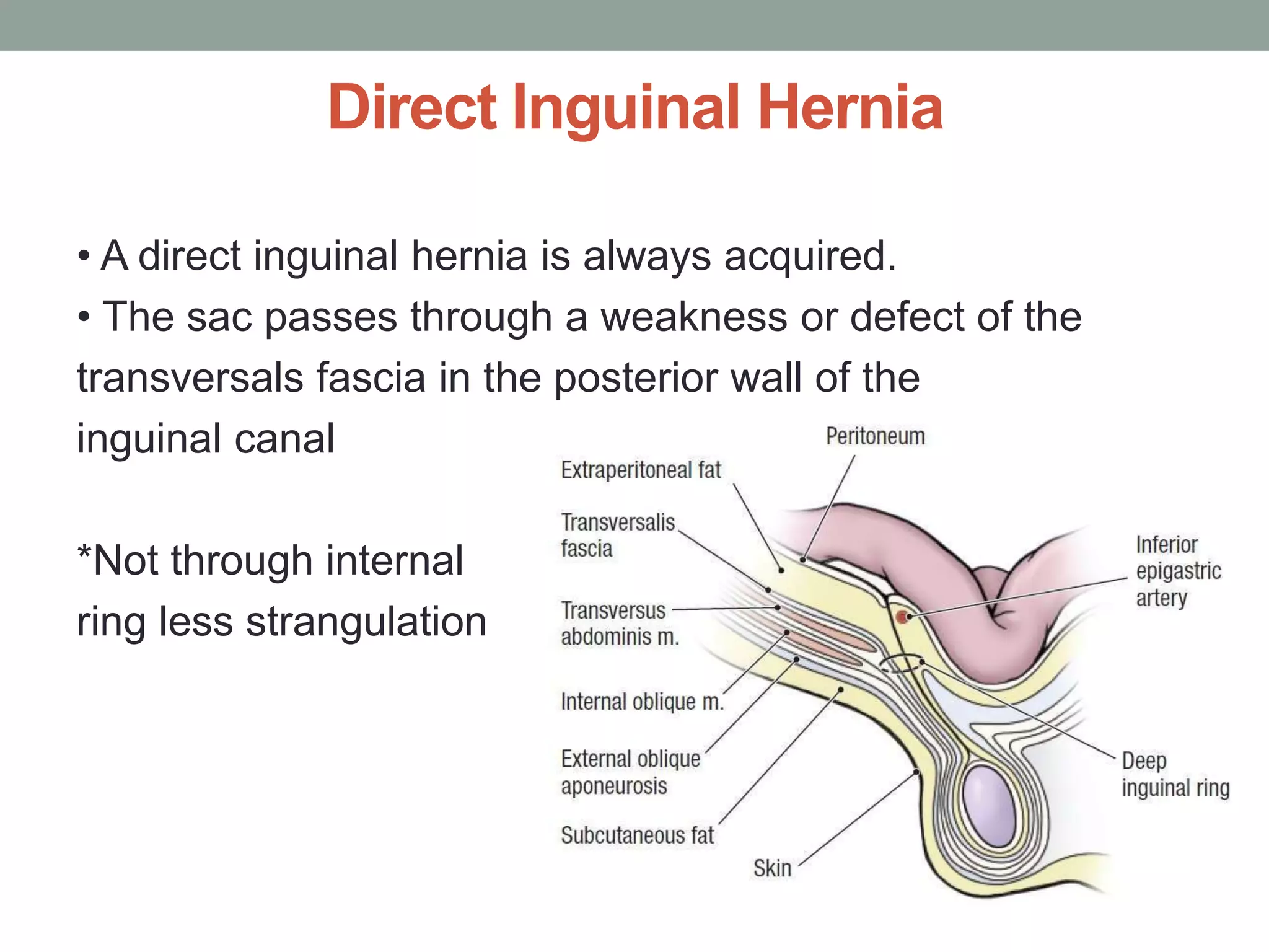 Hernias | PPTX
