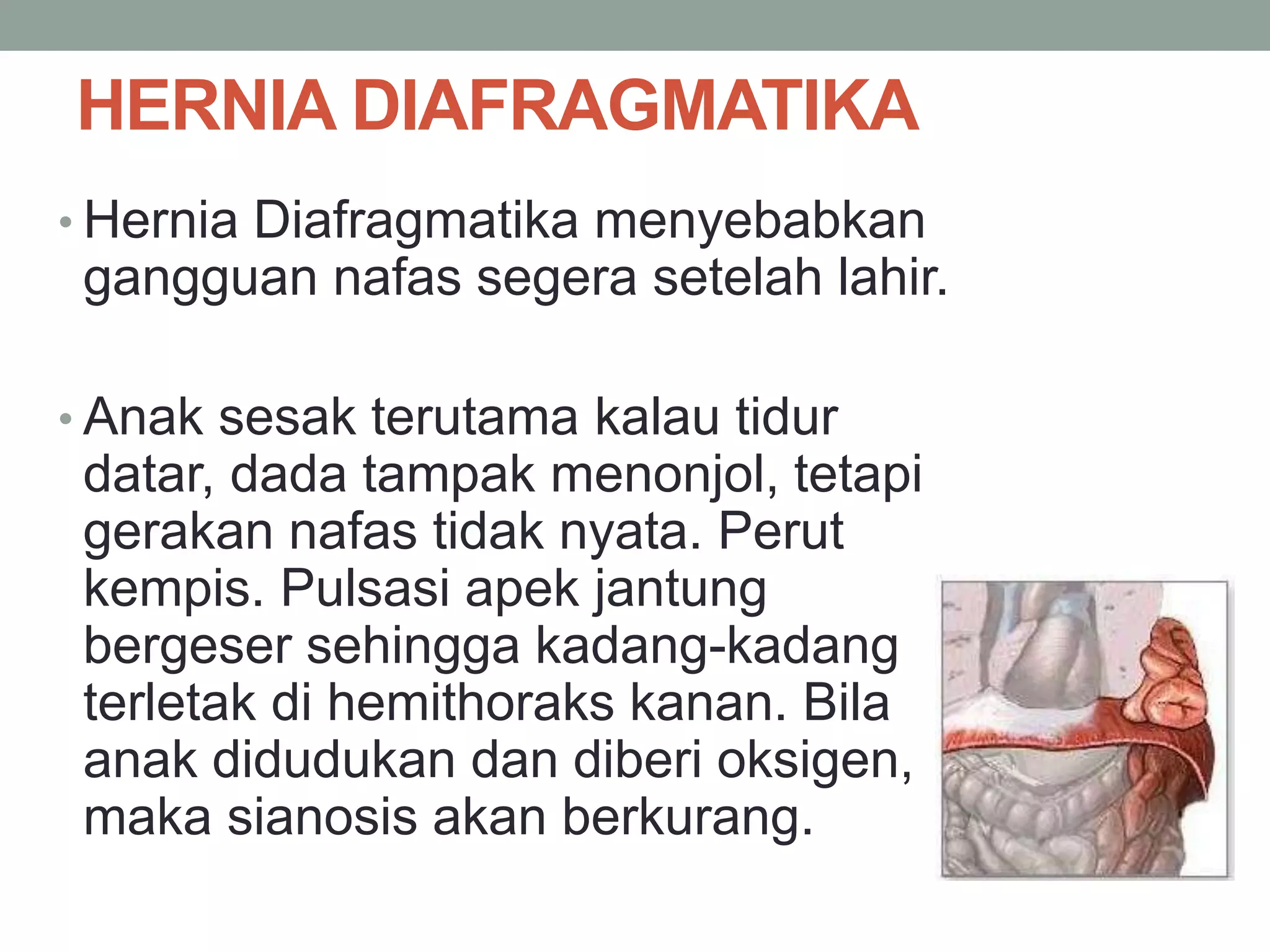 HERNIA.pptx
