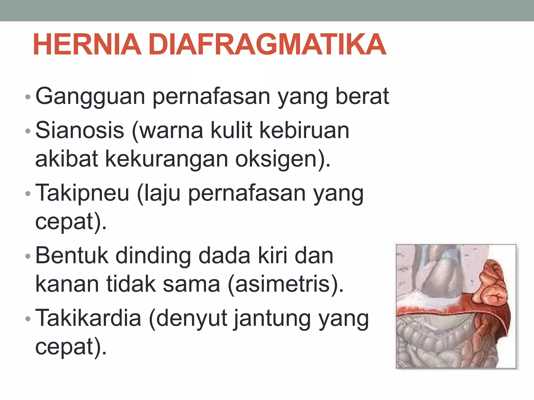 HERNIA.pptx