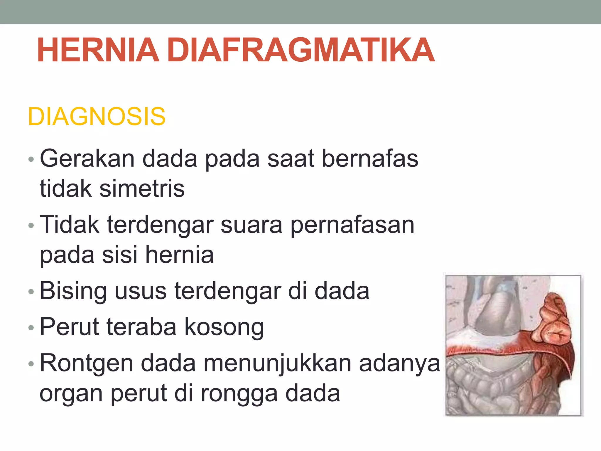 HERNIA.pptx