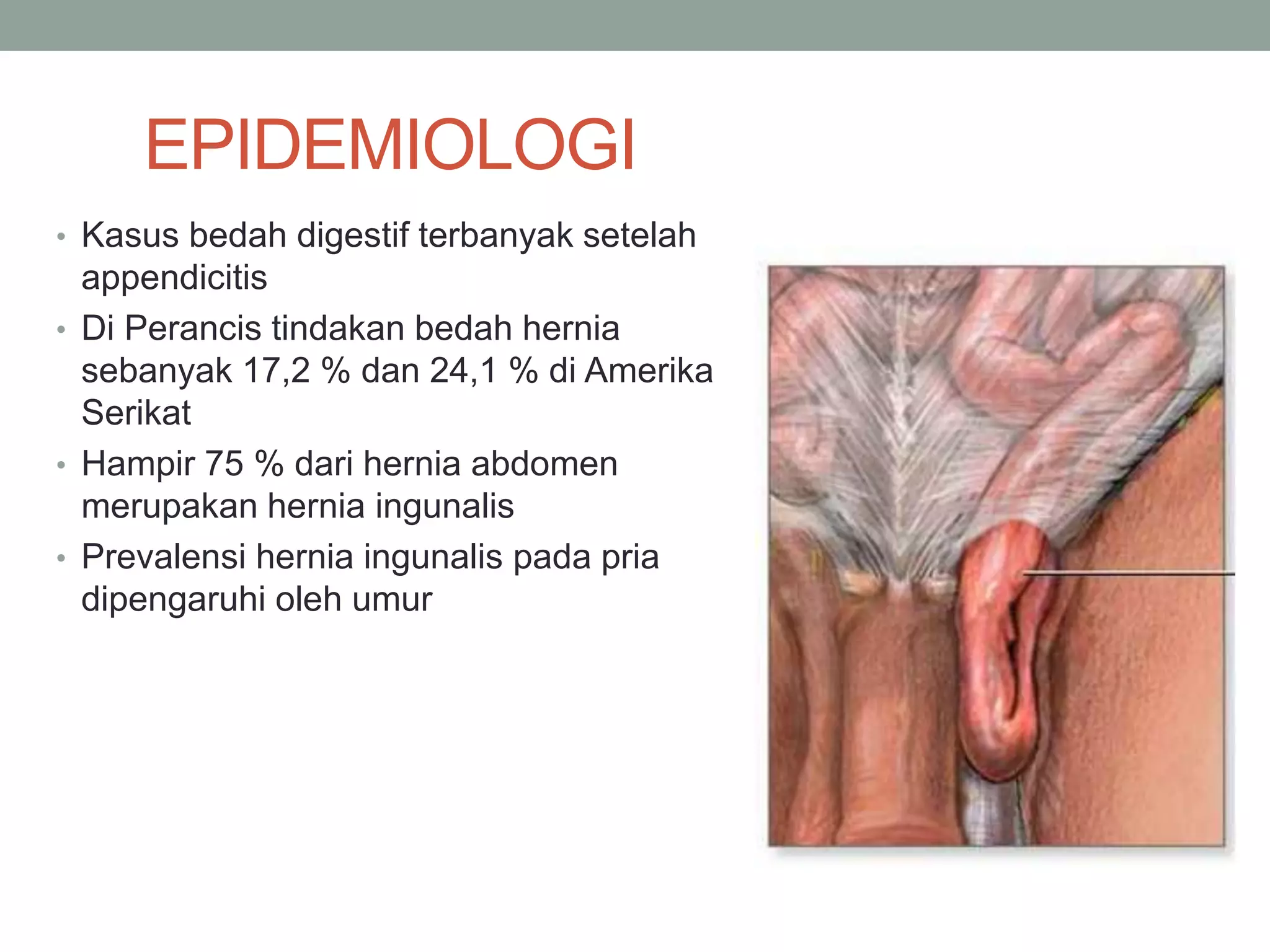 HERNIA.pptx