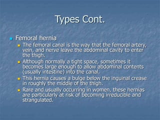 Hernia.ppt