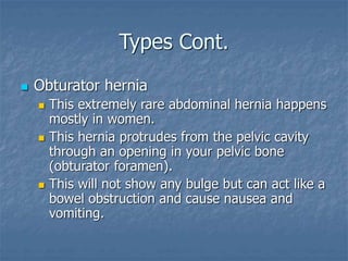 Hernia.ppt