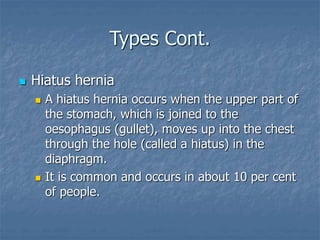 Hernia.ppt
