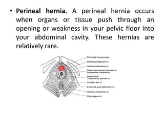 hernia.pptx