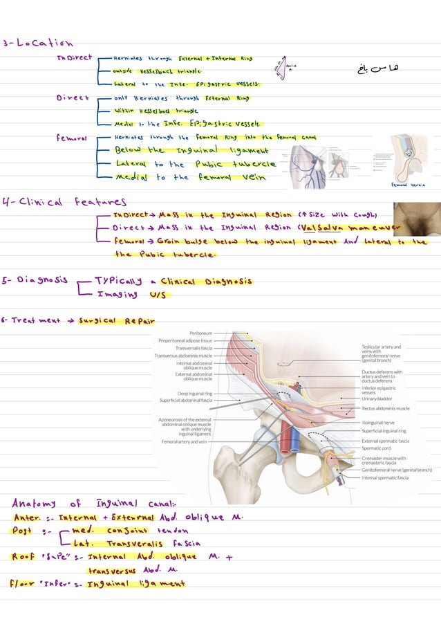 Hernia.pdf