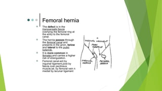 HERNIA.pptx
