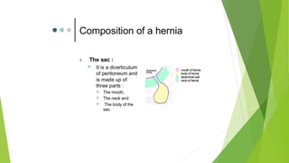 HERNIA.pptx