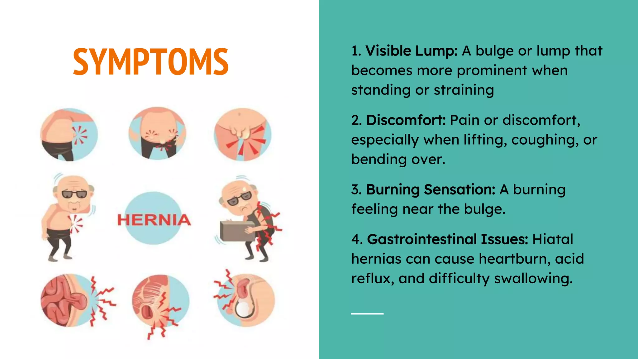 Hernia Home remedies.pptx