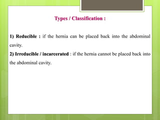 Hernia.pptx