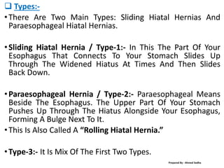 HERNIA & HIATAL HERNIA - GI DISORDERS.pptx