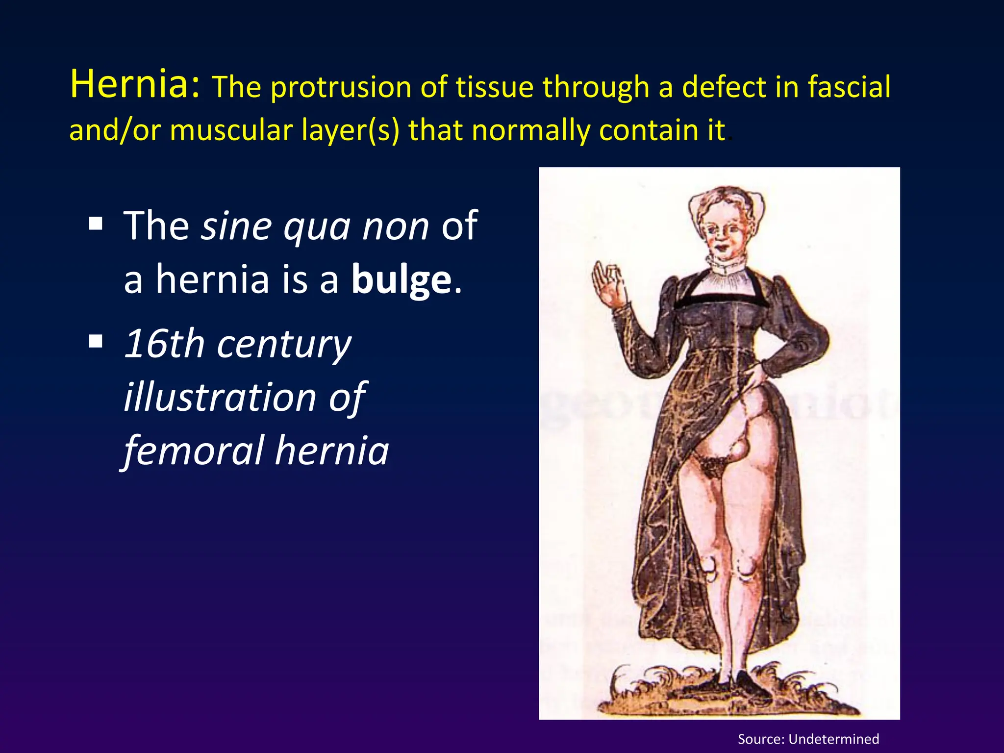 HERNIA isA hernia is a medical condition characterized by the ...