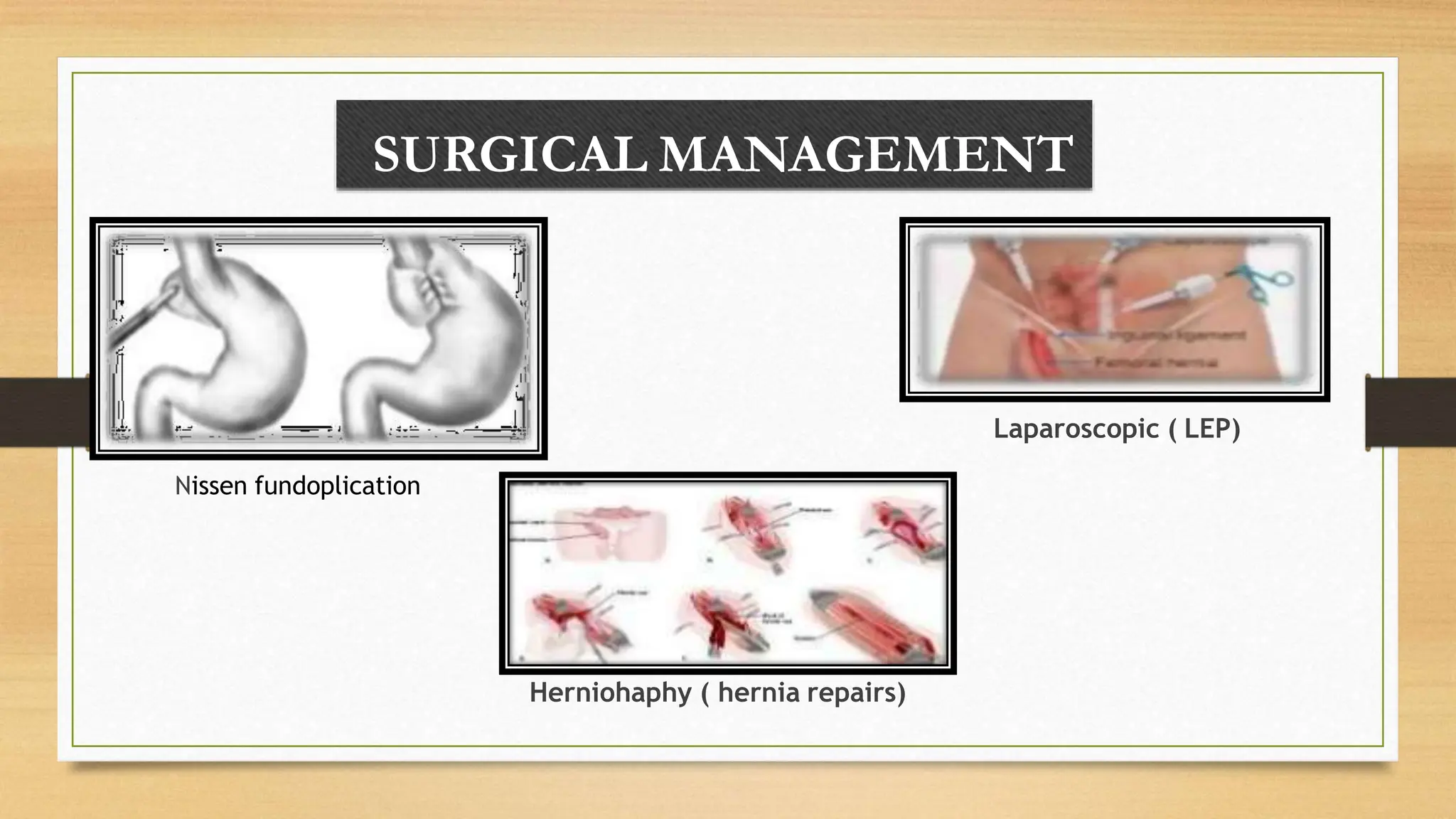 hernia and its treatment and nursing management .pptx