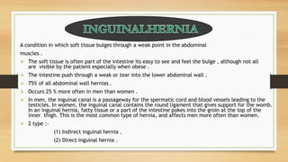 hernia and its treatment and nursing management .pptx