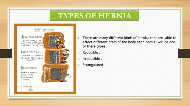hernia and its treatment and nursing management .pptx