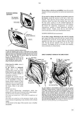 hernia inguinal different type and its techniques to repair | PDF
