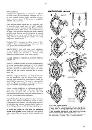 hernia inguinal different type and its techniques to repair | PDF