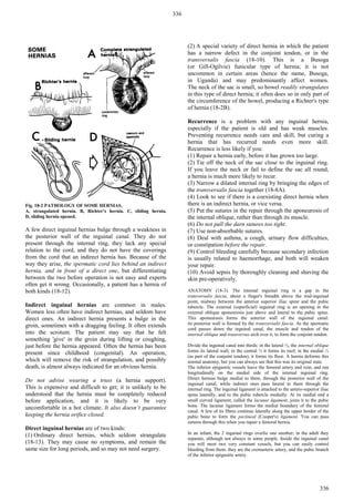 hernia inguinal different type and its techniques to repair | PDF