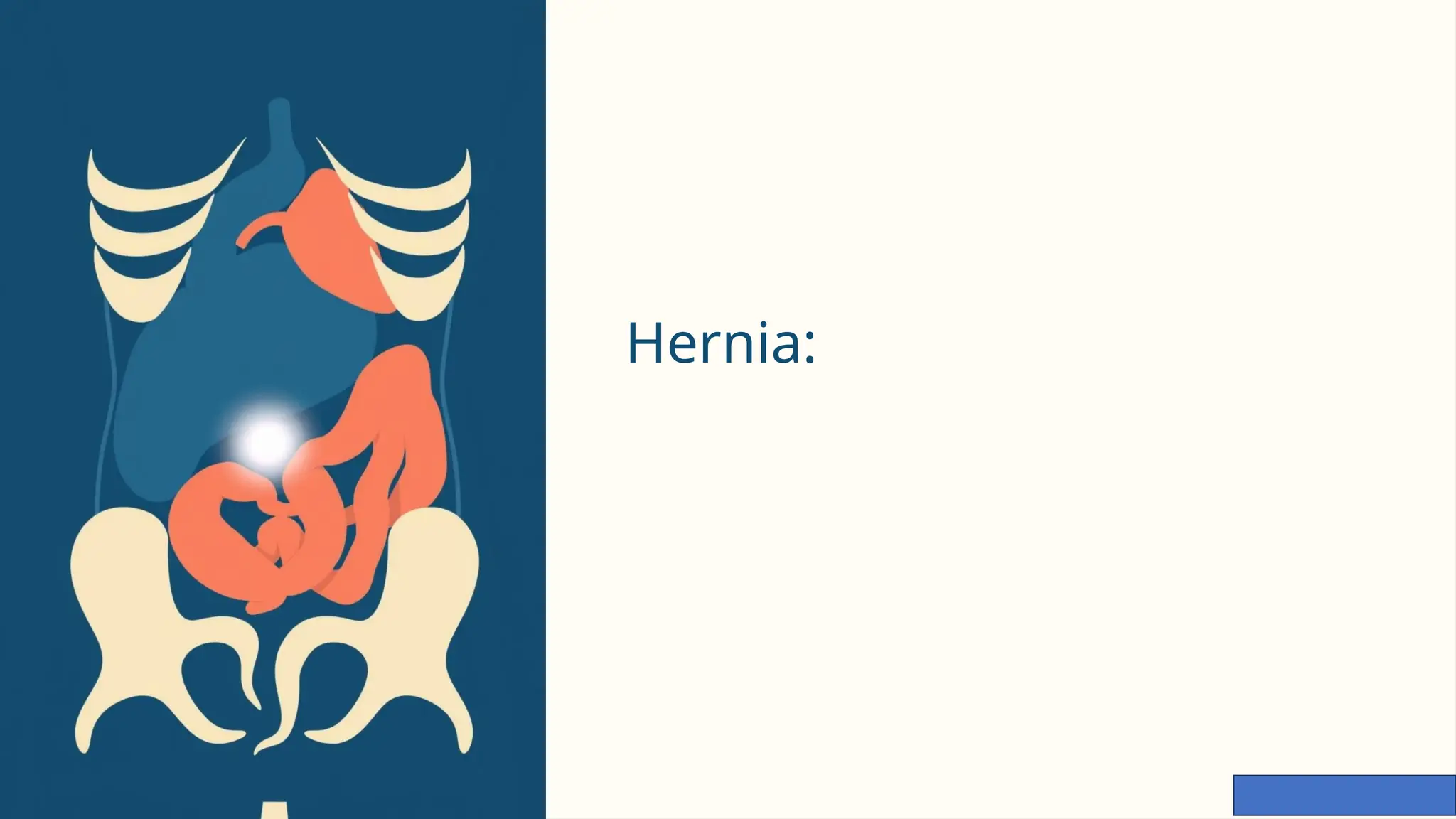 Mengenal apa itu hernia dan cara pencegahannya .pptx