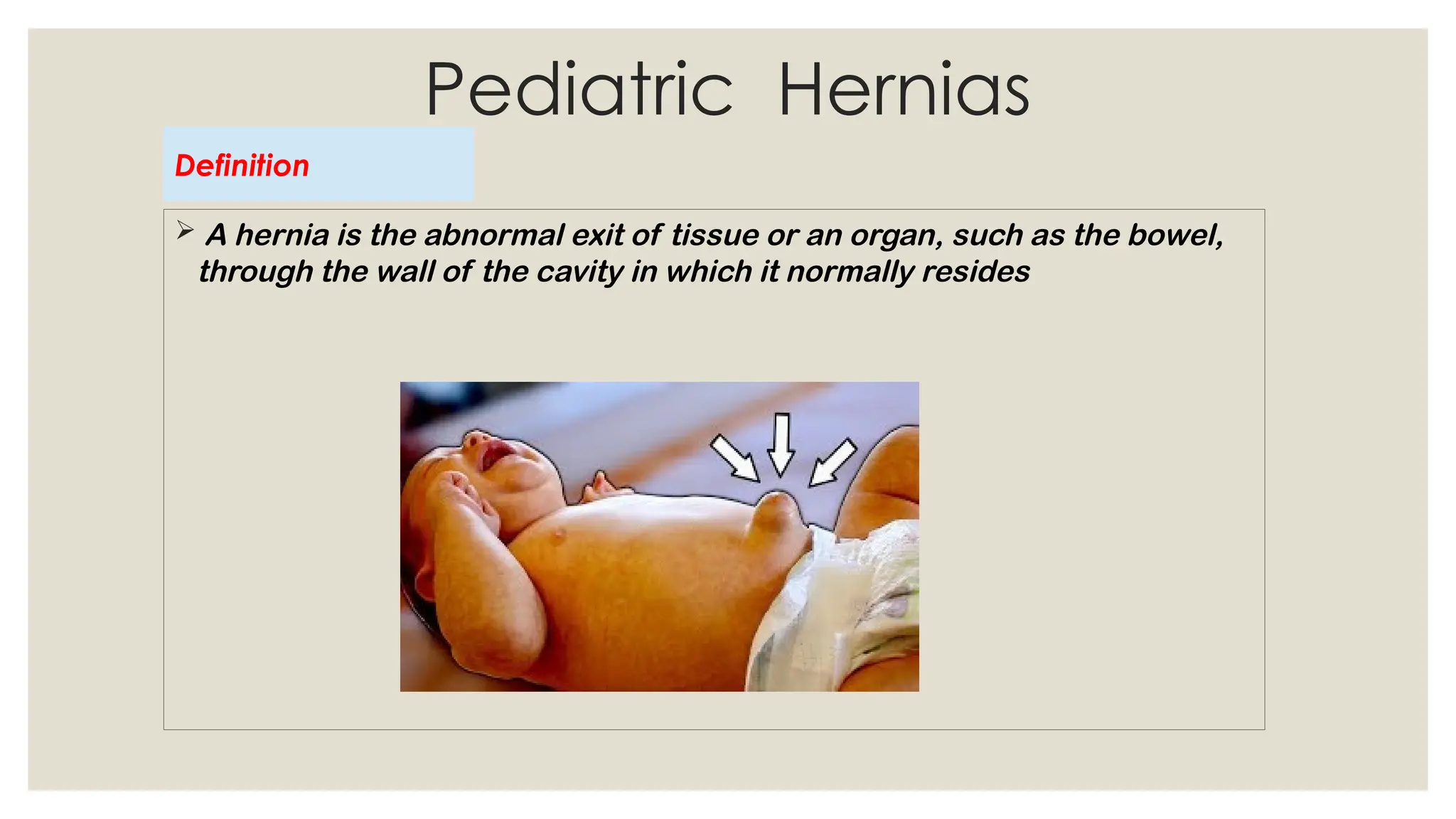 Pediatrics Hernias common types - by zmar.pptx