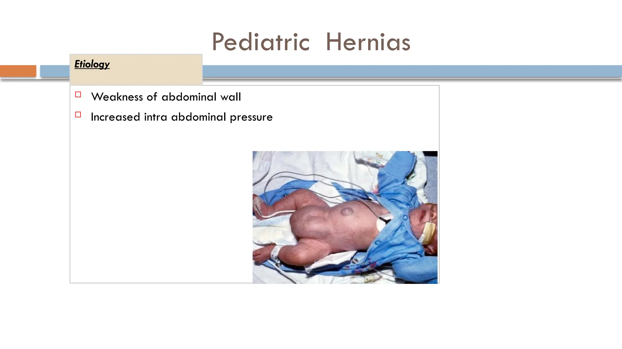 Pediatrics Hernias common types - by zmar.pptx