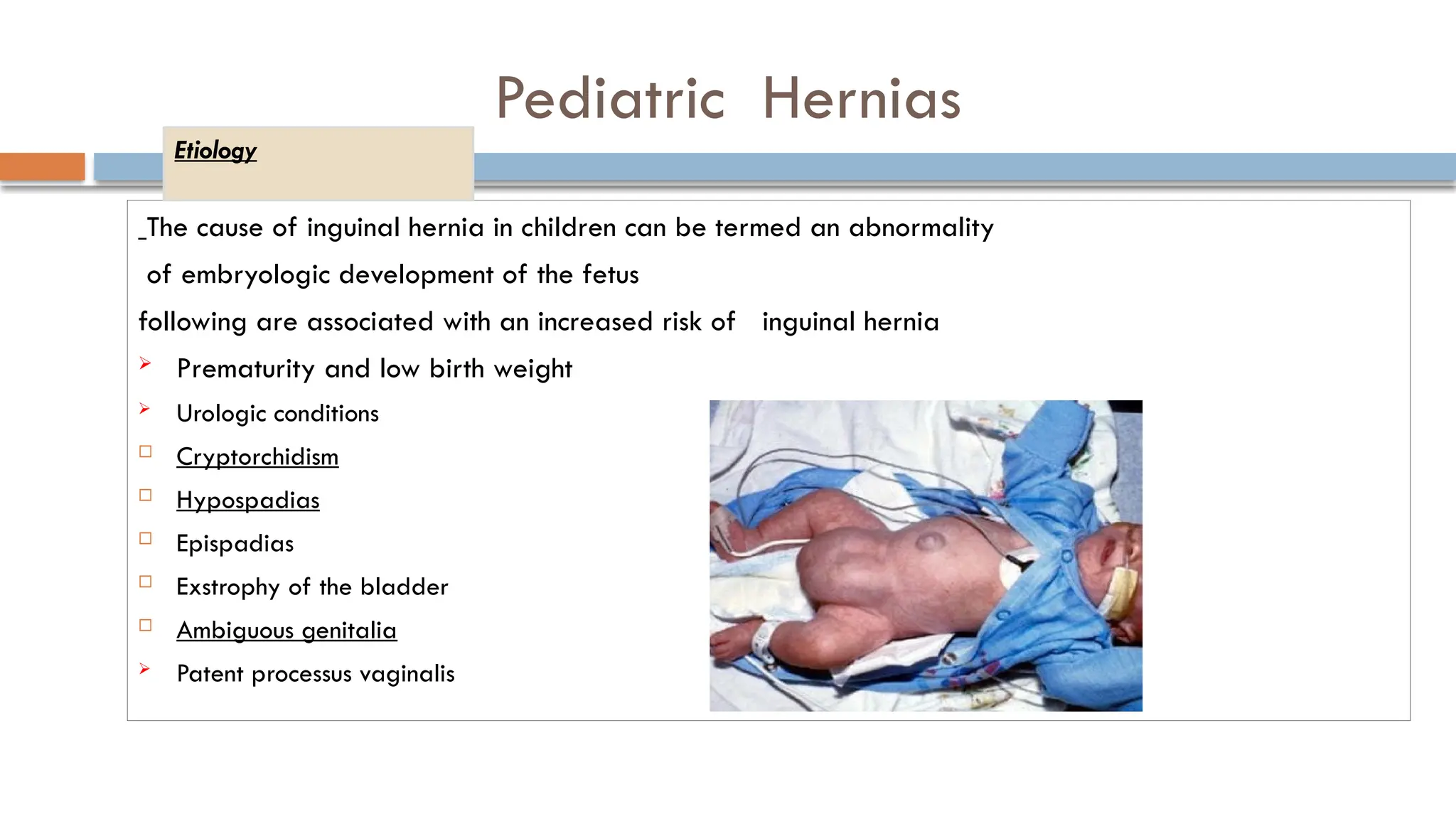 Pediatrics Hernias common types - by zmar.pptx