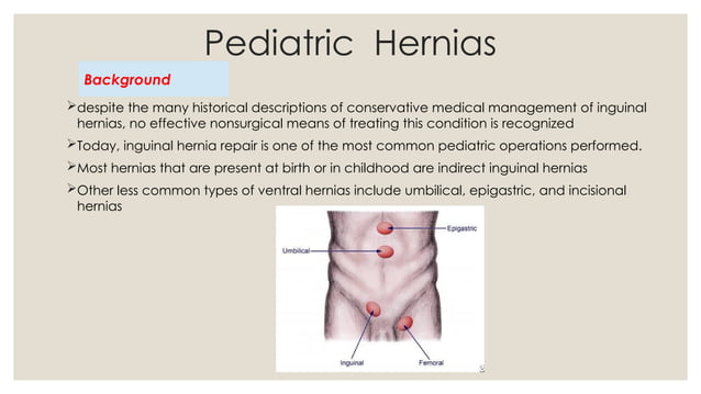 Pediatrics Hernias common types - by zmar.pptx