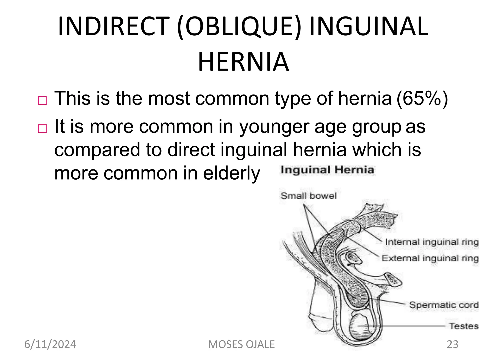hernia- good notes for DCM COMPLETE.pptx