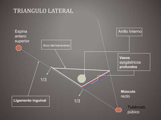 Triángulo Inguinal