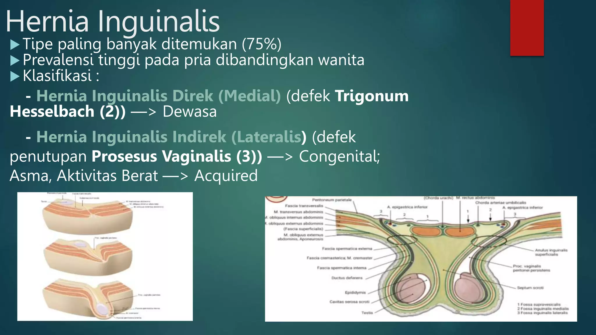 HERNIA - samuel.pptx