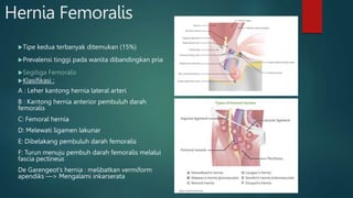 HERNIA - samuel.pptx